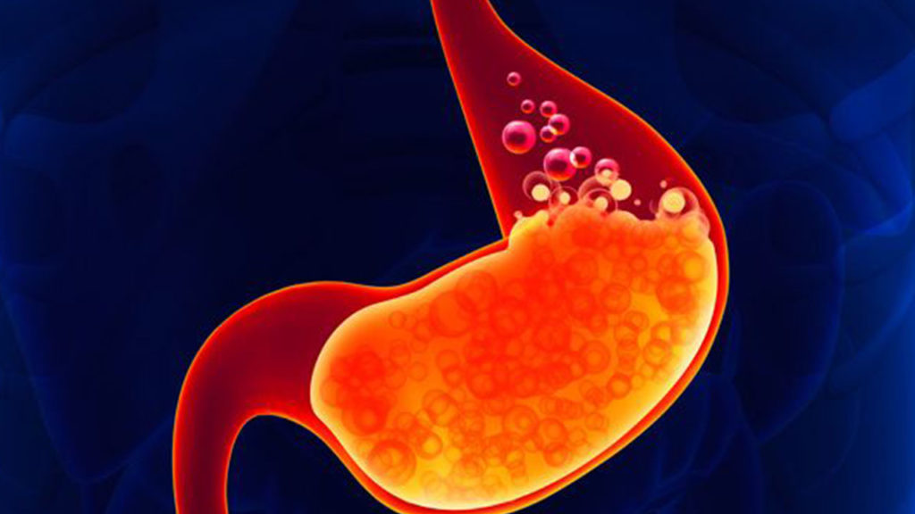 Reflujo gastroesofágico: Por qué Ocurre, Síntomas y Tratamientos