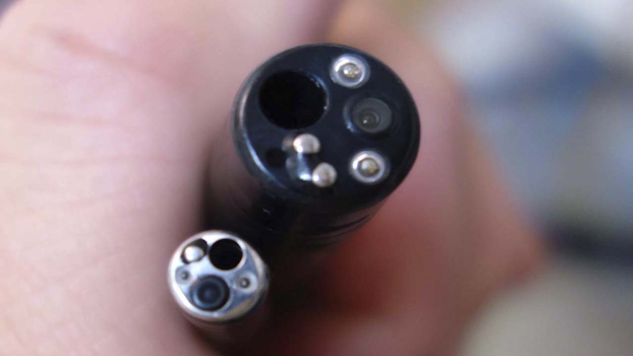 Endoscopía Nasal: ¿Para qué Sirve y Cuándo se Realiza?